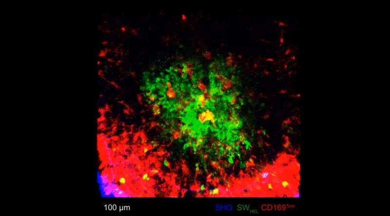 《Cell》首次追踪一种专门的垃圾处理细胞 - 生物通