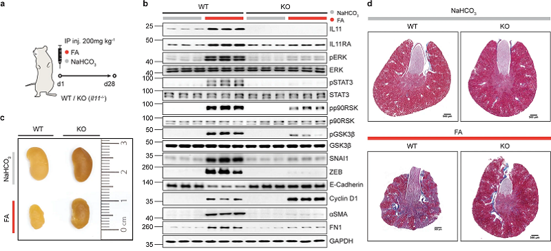 慢性肾病有救了？新研究表明IL11有望成为治疗靶点，促进肾脏再生 - 生物通