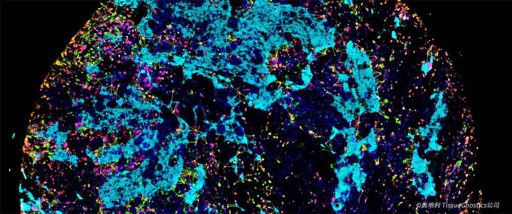 TissueFAXS Cytometry组织流式定量分析软件升级版本正式发布