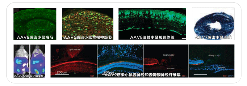 吉满生物AAV试用装免费领，多种血清型可选。AAV-活体实验利器！