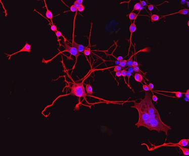 IN Cell Analyzer 2000：让最具挑战性的高内涵分析高效完成[创新技巧] - 生物通