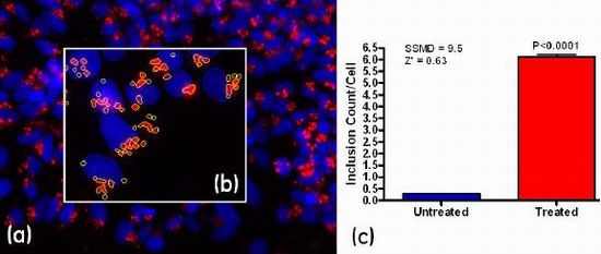 IN Cell Analyzer 2000：让最具挑战性的高内涵分析高效完成[创新技巧] - 生物通