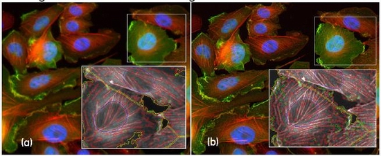 IN Cell Analyzer 2000：让最具挑战性的高内涵分析高效完成[创新技巧] - 生物通