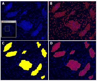 利用IN Cell Analyzer 2000系统分析干细胞克隆[创新技巧] - 生物通