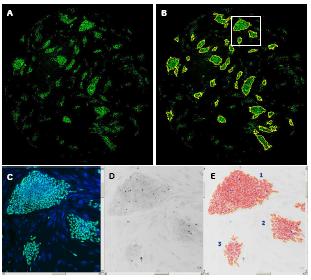 利用IN Cell Analyzer 2000系统分析干细胞克隆[创新技巧] - 生物通