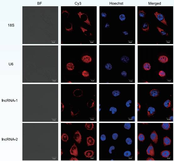 lncRNA FISH检测试剂盒 - 生物通
