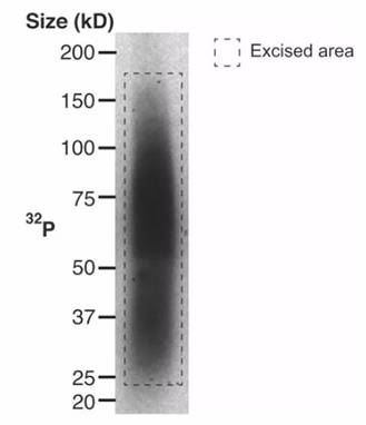 RNA甲基化修饰——如何检测m6A - 生物通